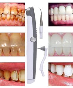 Electric Ultrasonic Tooth Stain Eraser - Not sold in stores