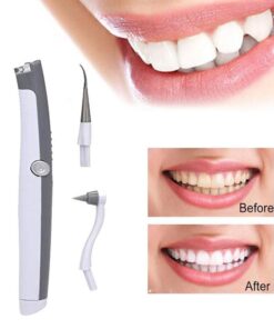 Electric Ultrasonic Tooth Stain Eraser - Not sold in stores