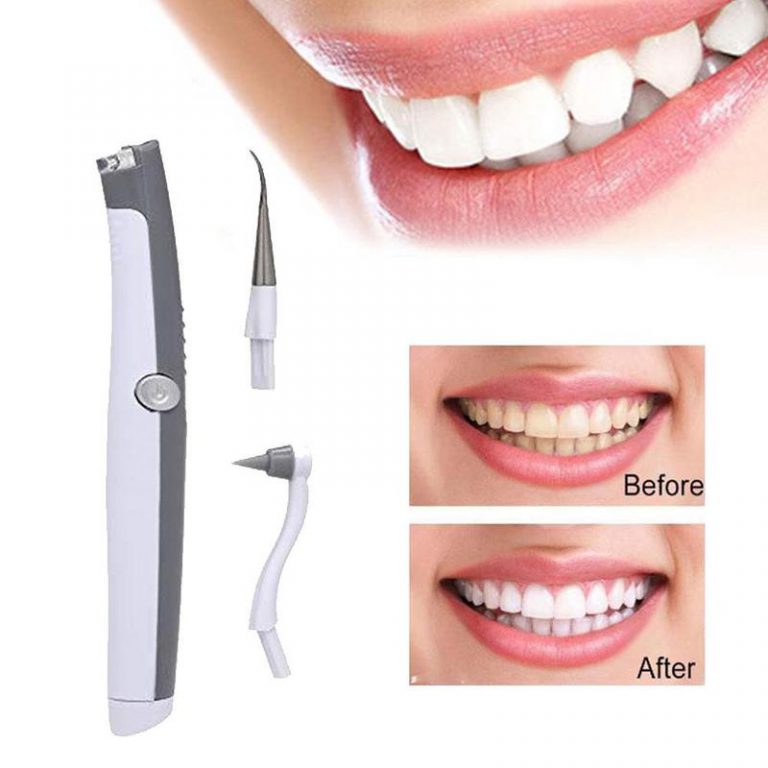Electric Ultrasonic Tooth Stain Eraser - Not sold in stores