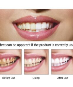 Teeth Whitening Essence Liquid - Not sold in stores